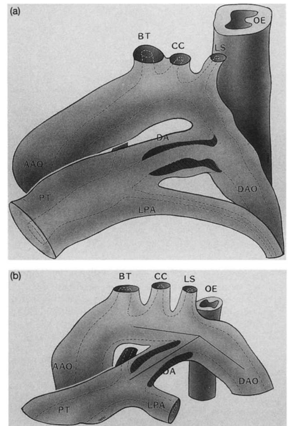 (a) graphic reconstruction of a 45 mm crl (10 weeks) embryo