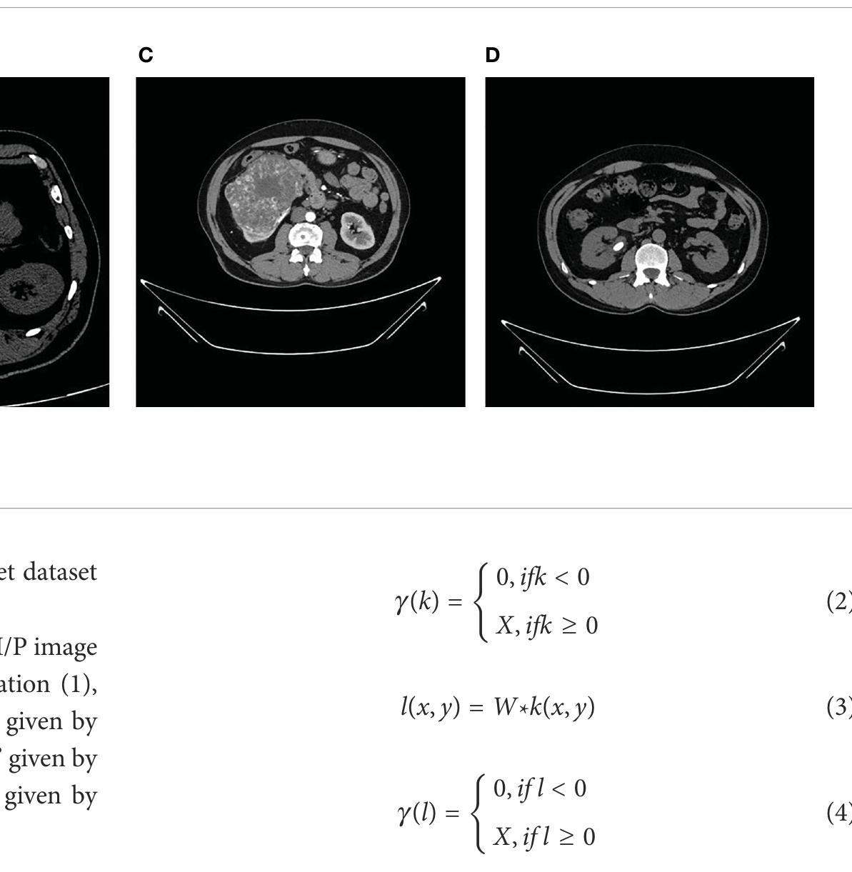Figure 4 - A multi-class deep learning model for early lung