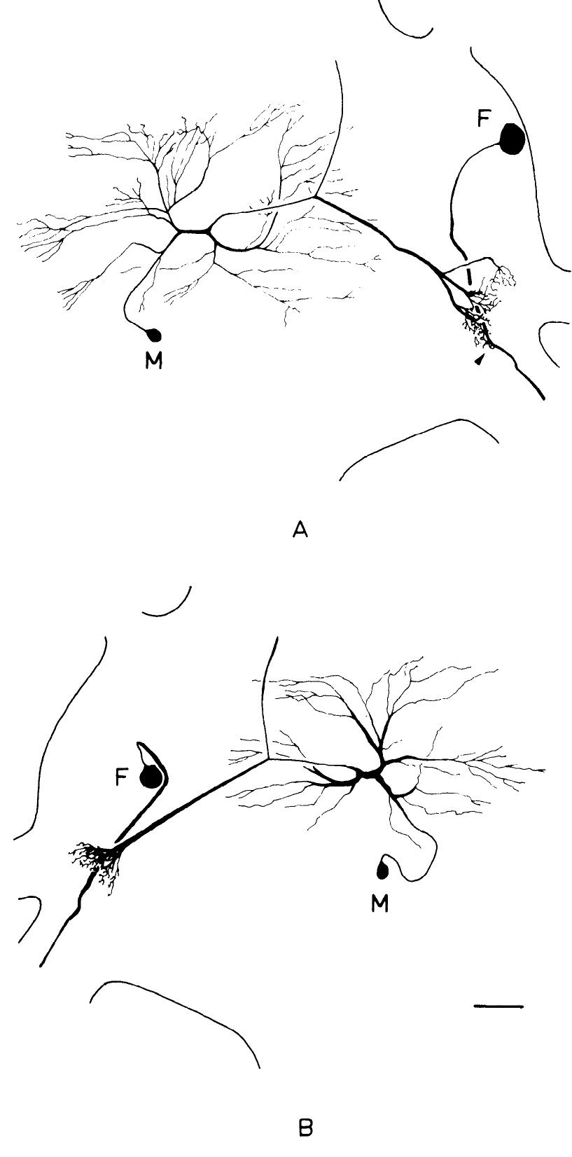Drawings of two examples of double staining of an m-neuron