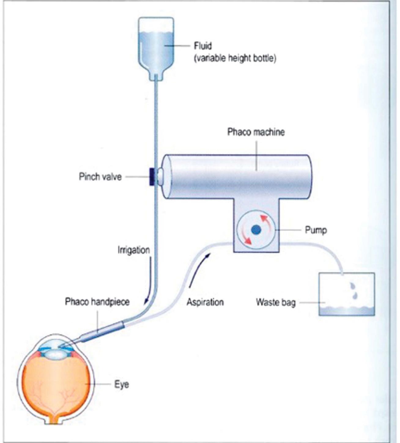 Diagram showing the general set up and principles of a