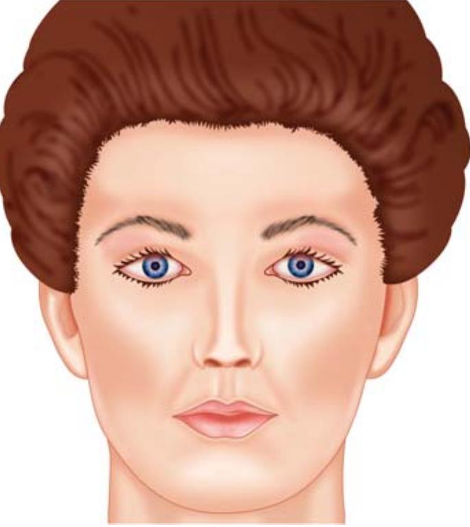 The contour of the alar rims and nasal tip fig. 21: the tip