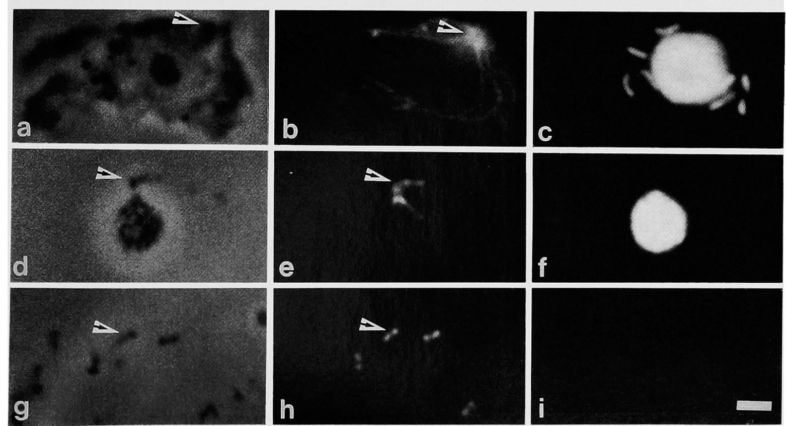 Effect of nacl on triton x-100-treated amoeba cell. cells