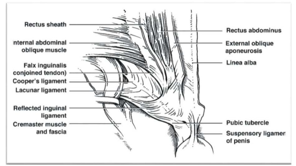 Figure 1 - from Reflected Inguinal Ligament A Potential A