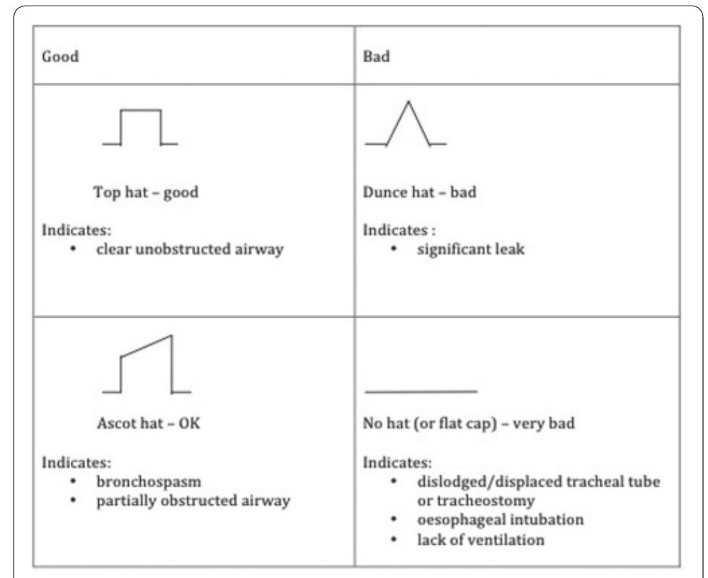 (abstract p264). ‘hats and caps’ capnography training guide.