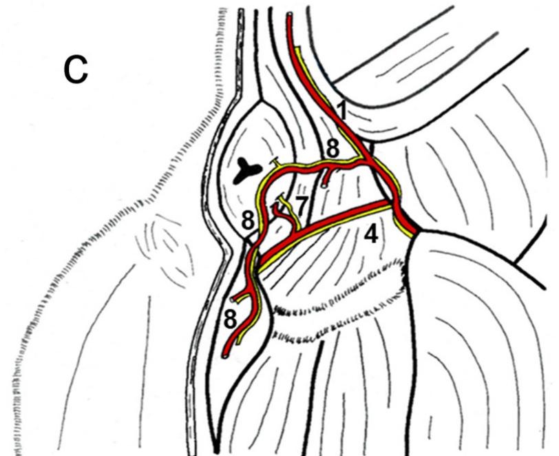 Schematic representation of the anatomical variations of the