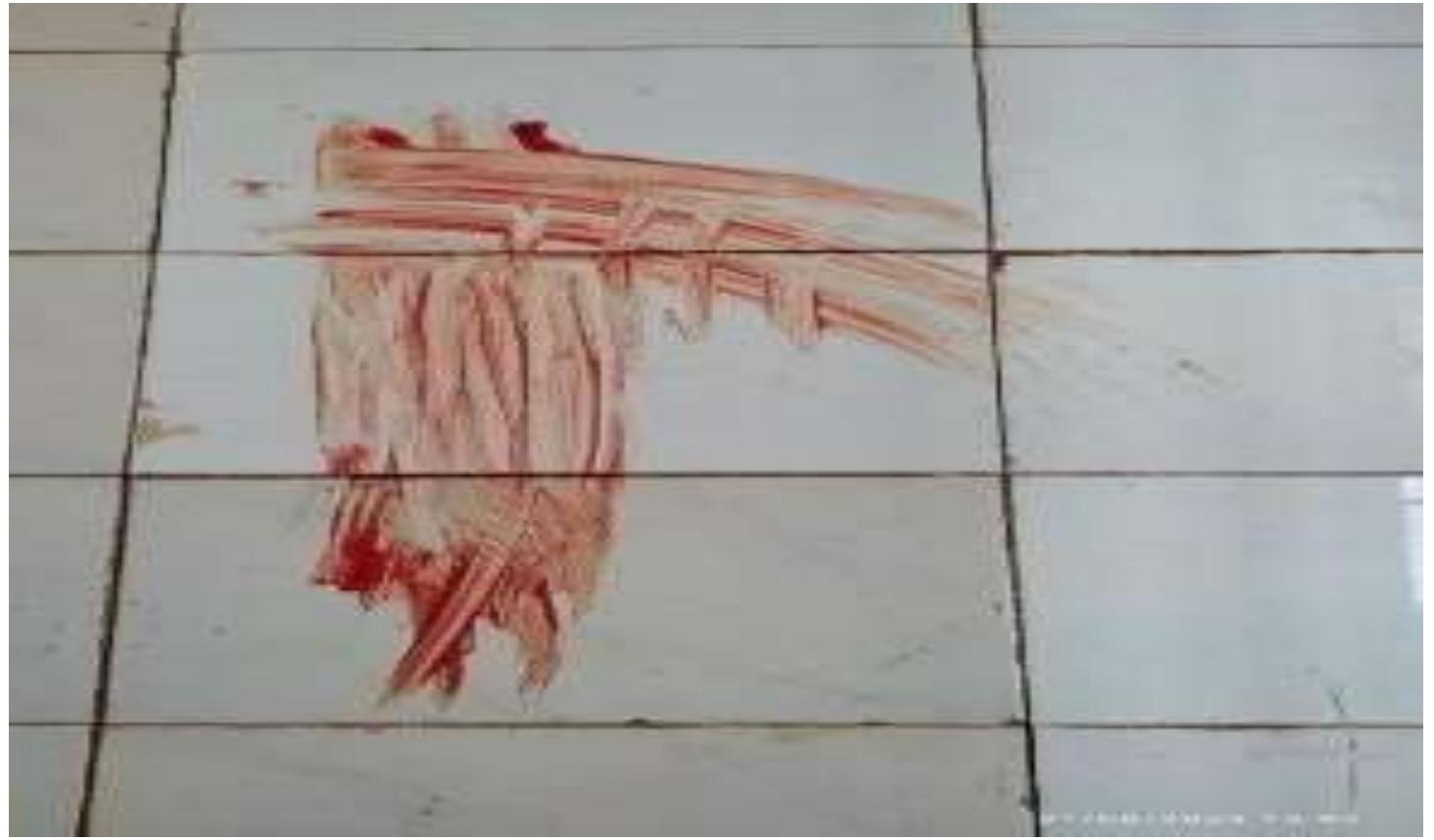 (PDF) AN EXPERIMENTAL ANALYSIS OF BLOOD IN FORENSIC SCIENCE: BLOOD ...