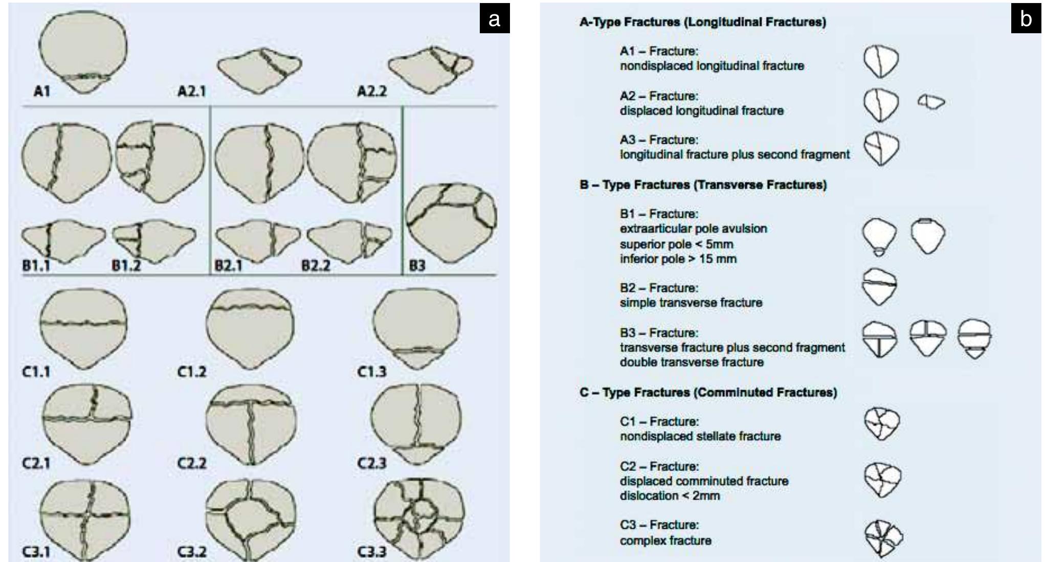 The ao — classification (a) is based on the classification