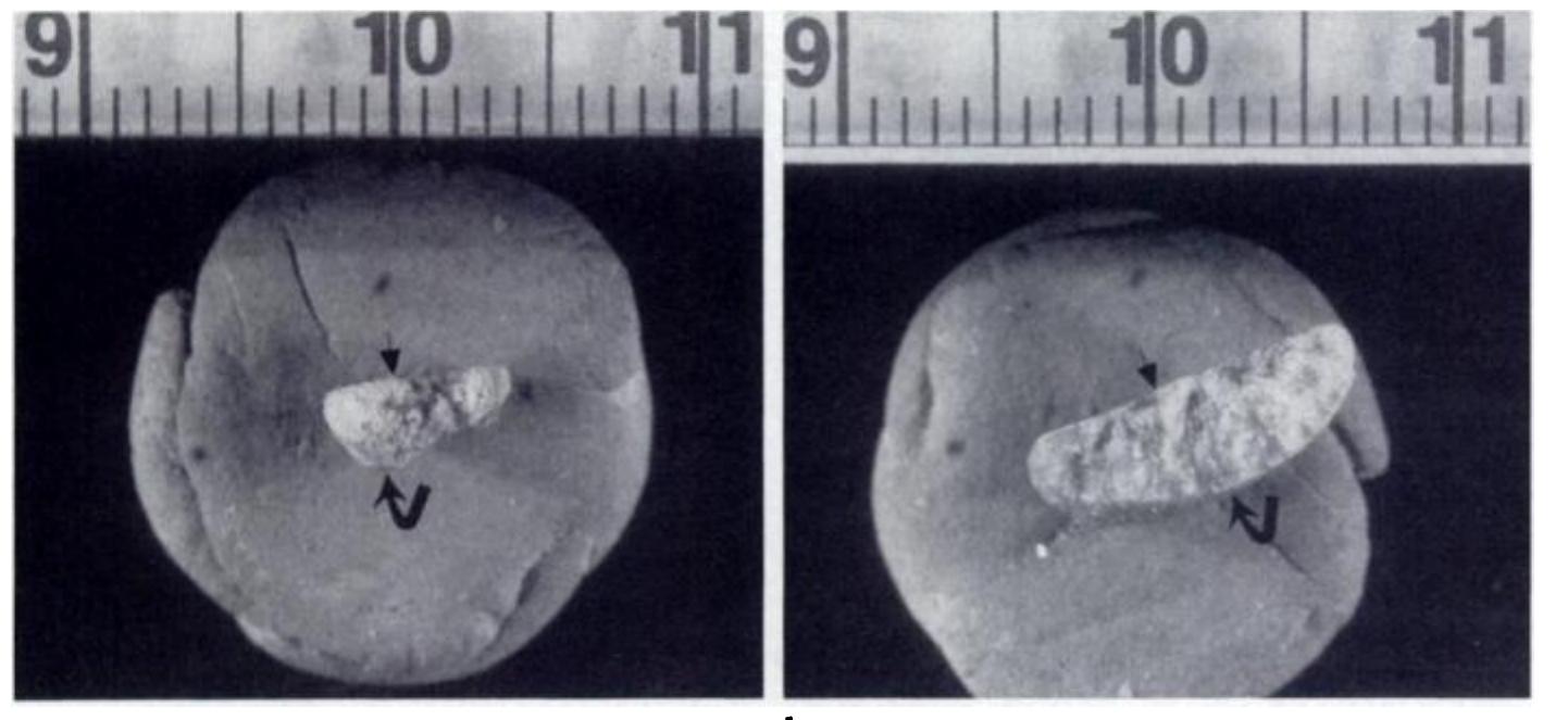 Elevation photographs of (a) triple-phosphate stone and (b)