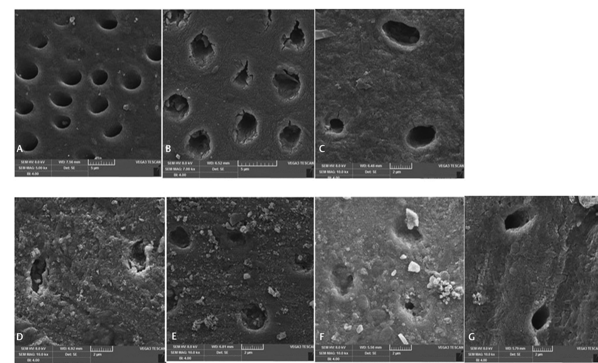 (a) scanning electron microscopy (sem) micrograph of dentin