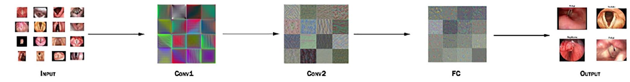 Convolutional neural network. conv = convolution; fc = fully
