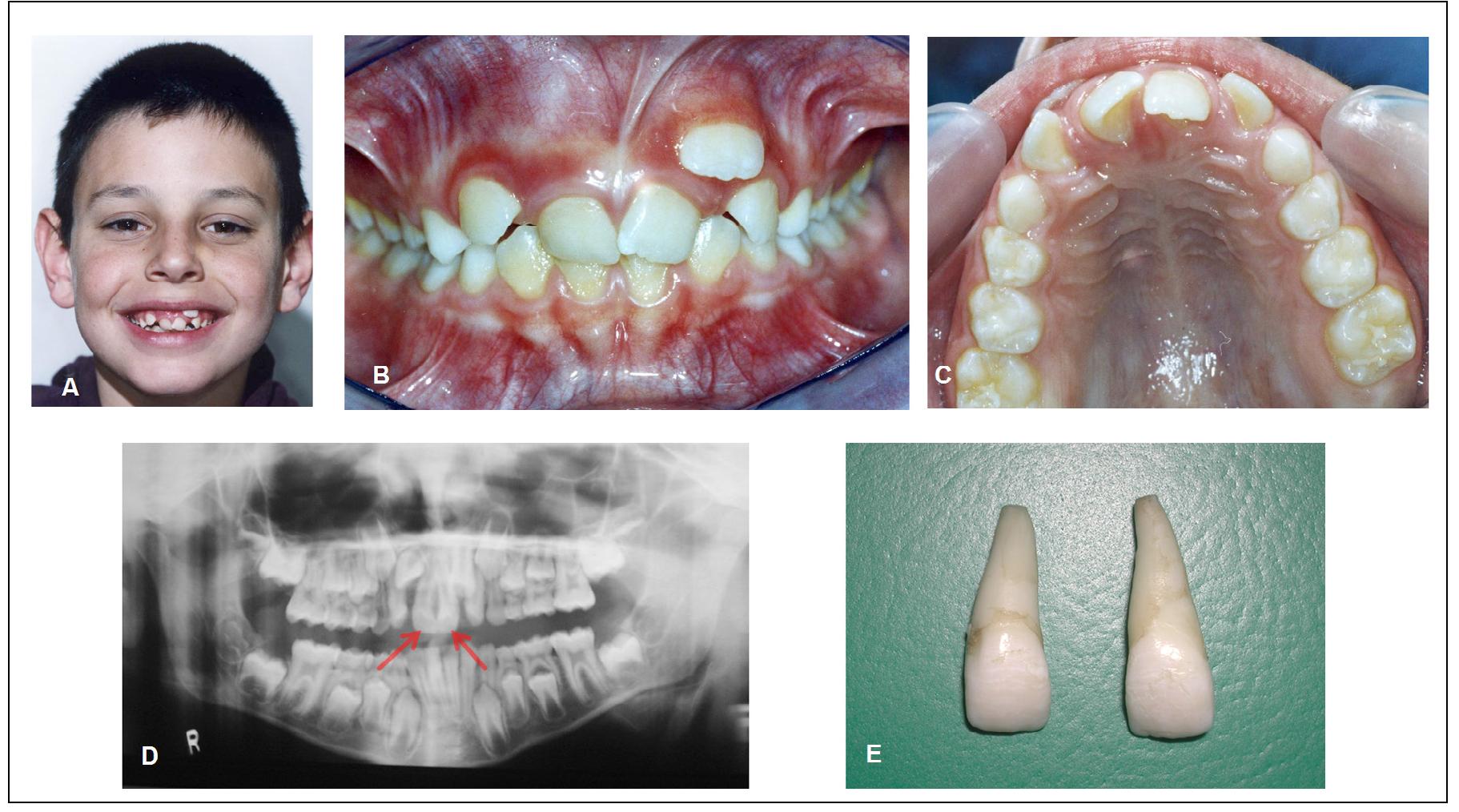 Facial smiling view, b — frontal and c- occlusal views