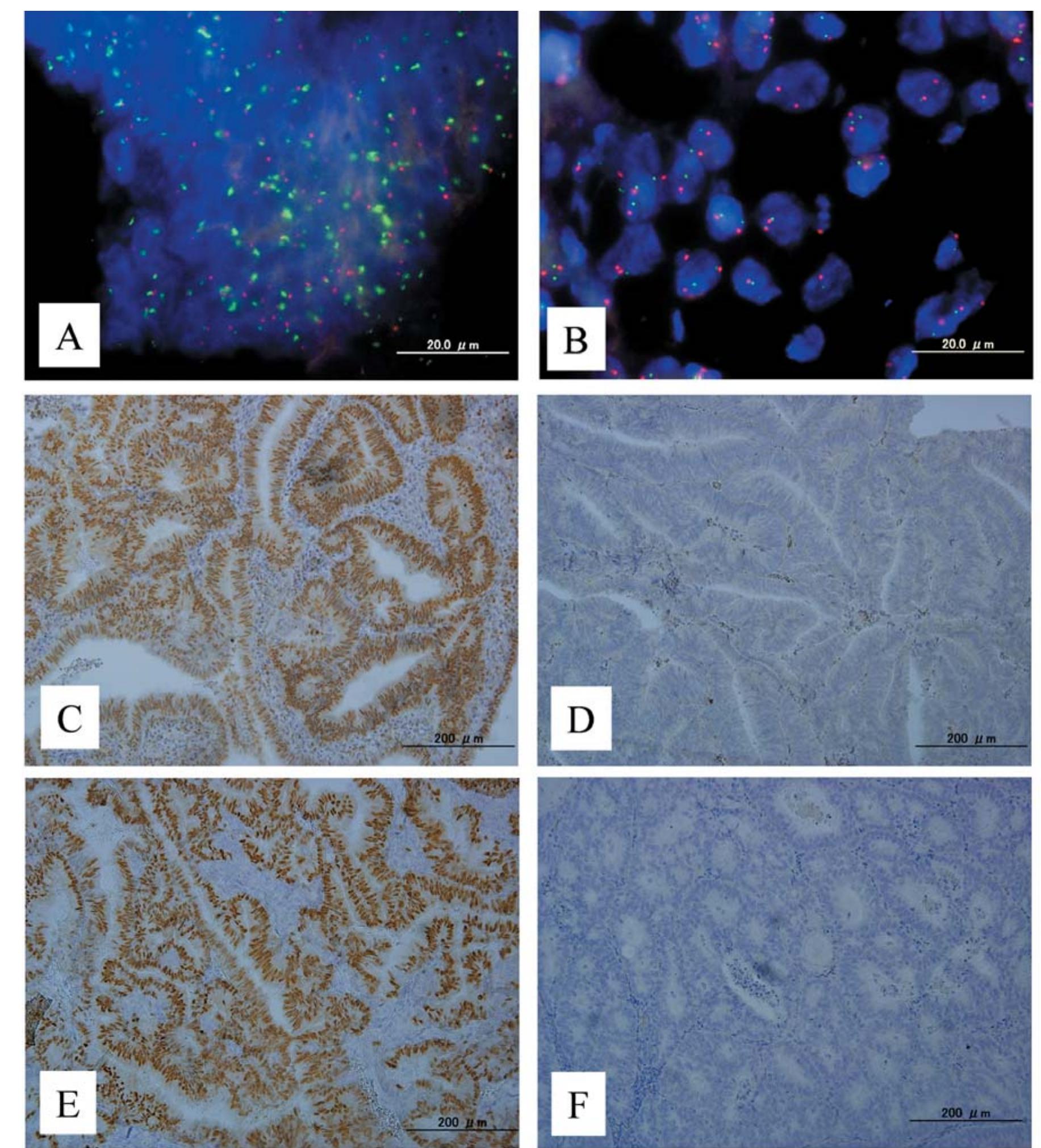 Dual-color fluorescence in situ hybridization (fish)