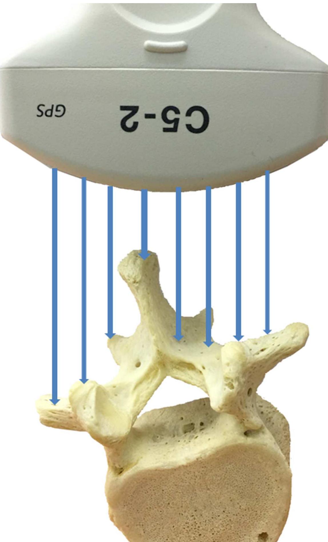 The schematic of ultrasound beam propagating from the
