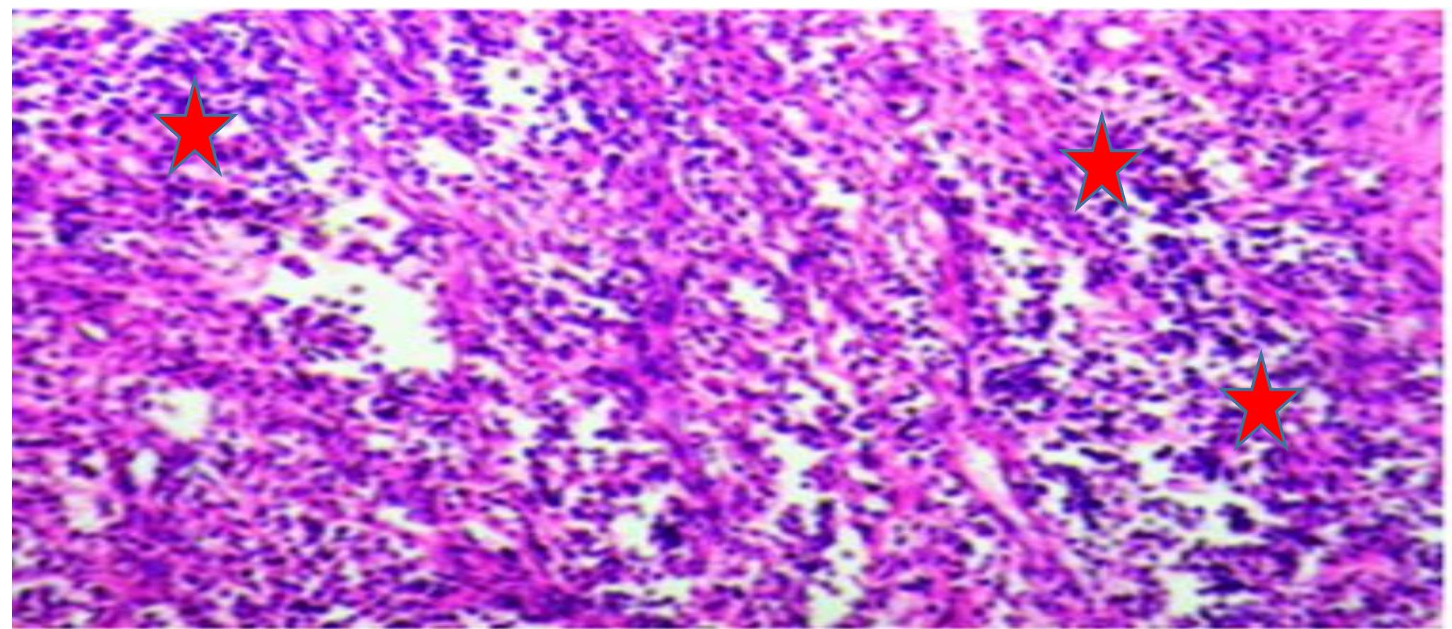 Histological appearances of lymphosarcoma in cattle