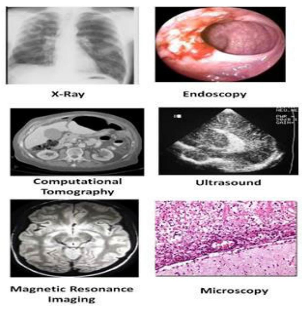Various imaging techniques. among various techniques to