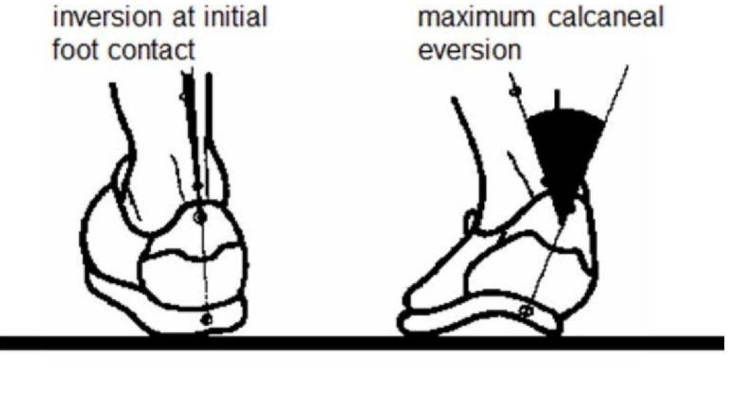 Illustration of the rearfoot positions at initial foot