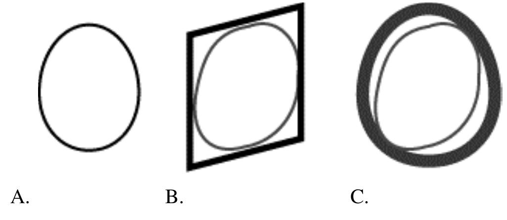 A. normal head shape. b. parallelogram shape of head of