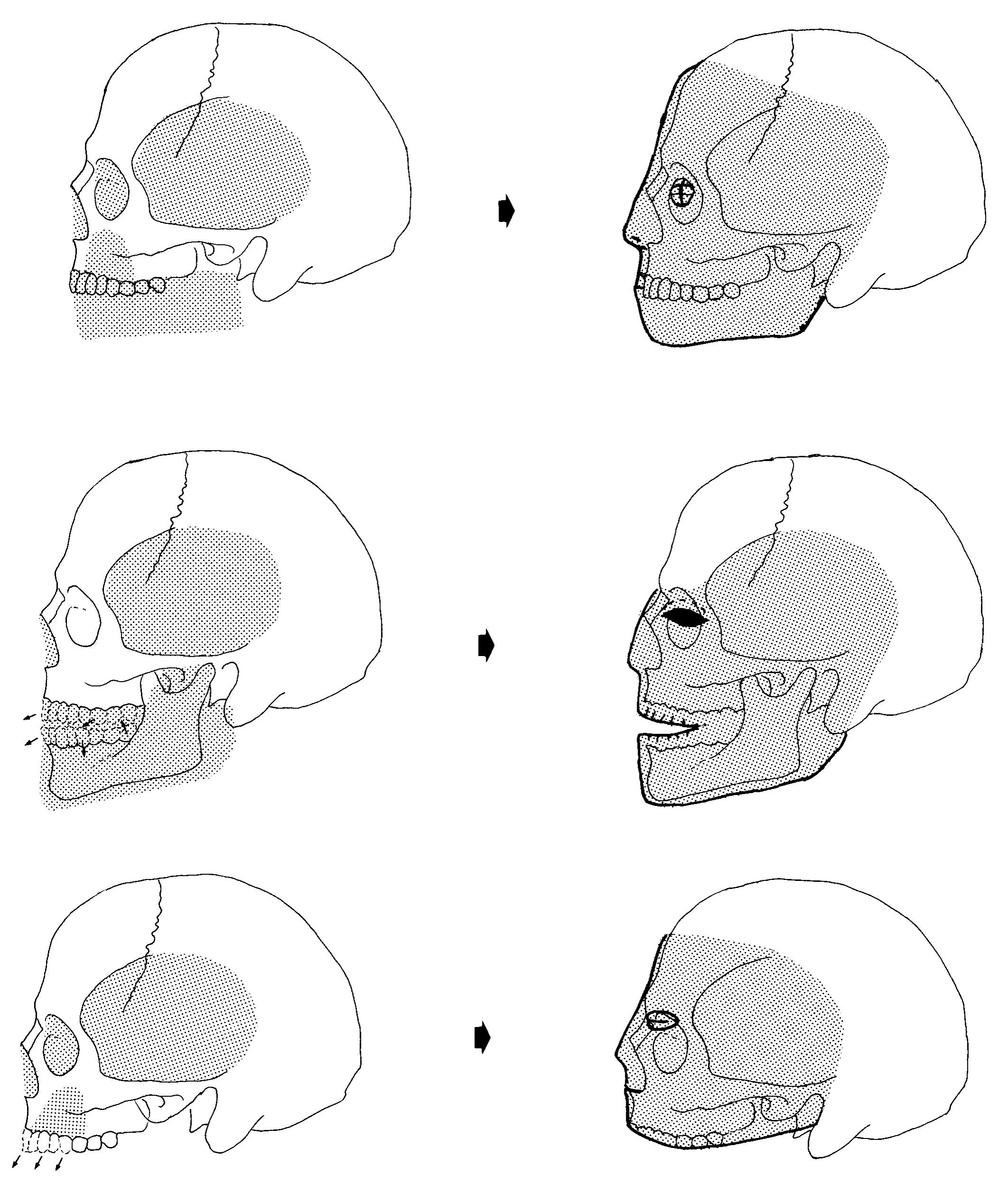 A schematic reconstruction of the modelling methods as