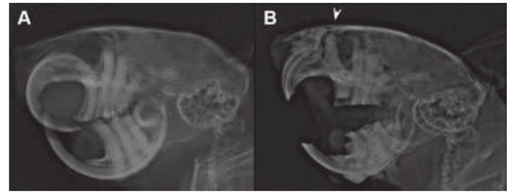 Severe case of dental disease in two 3-5-year-old male