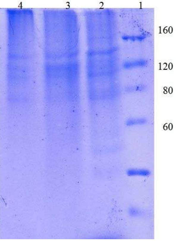Hplc chart of sugar analysis of date palm extract fig. 2: