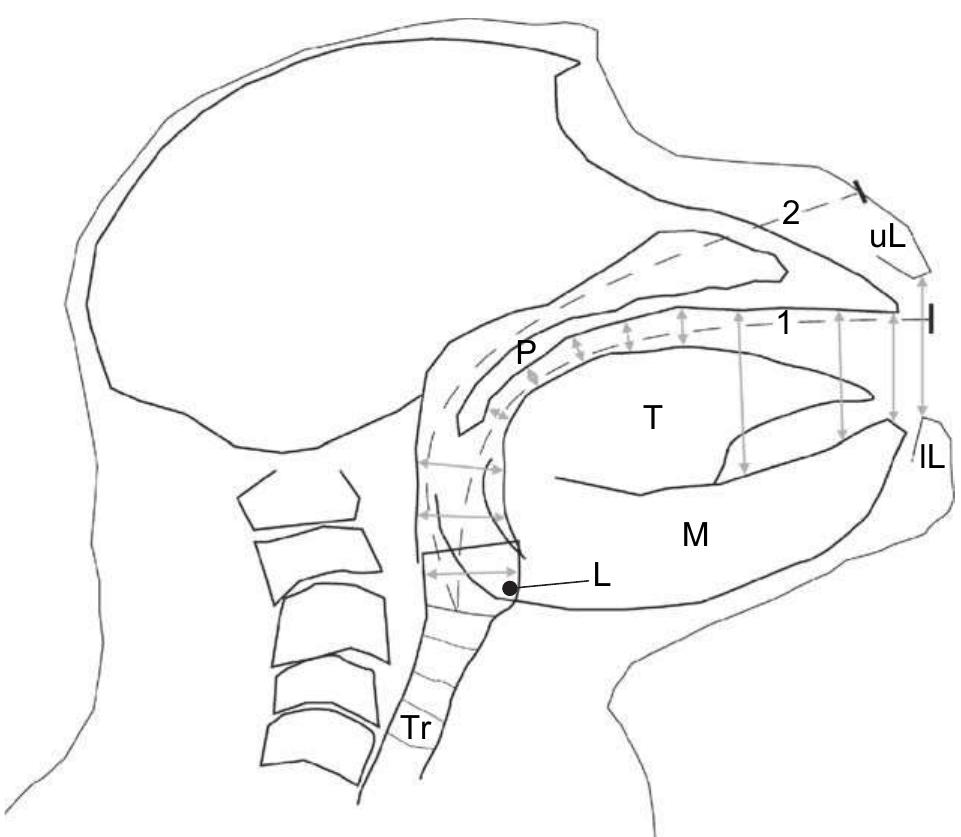 Schematic drawing of the head-neck region of a diana monkey