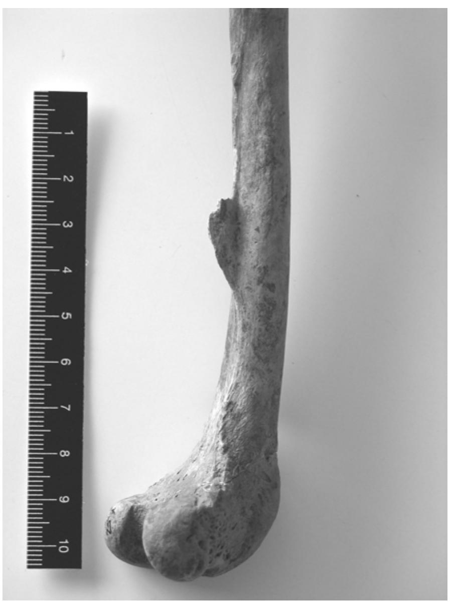 18: ossification in a dog femur; lateral view (tlp otw
