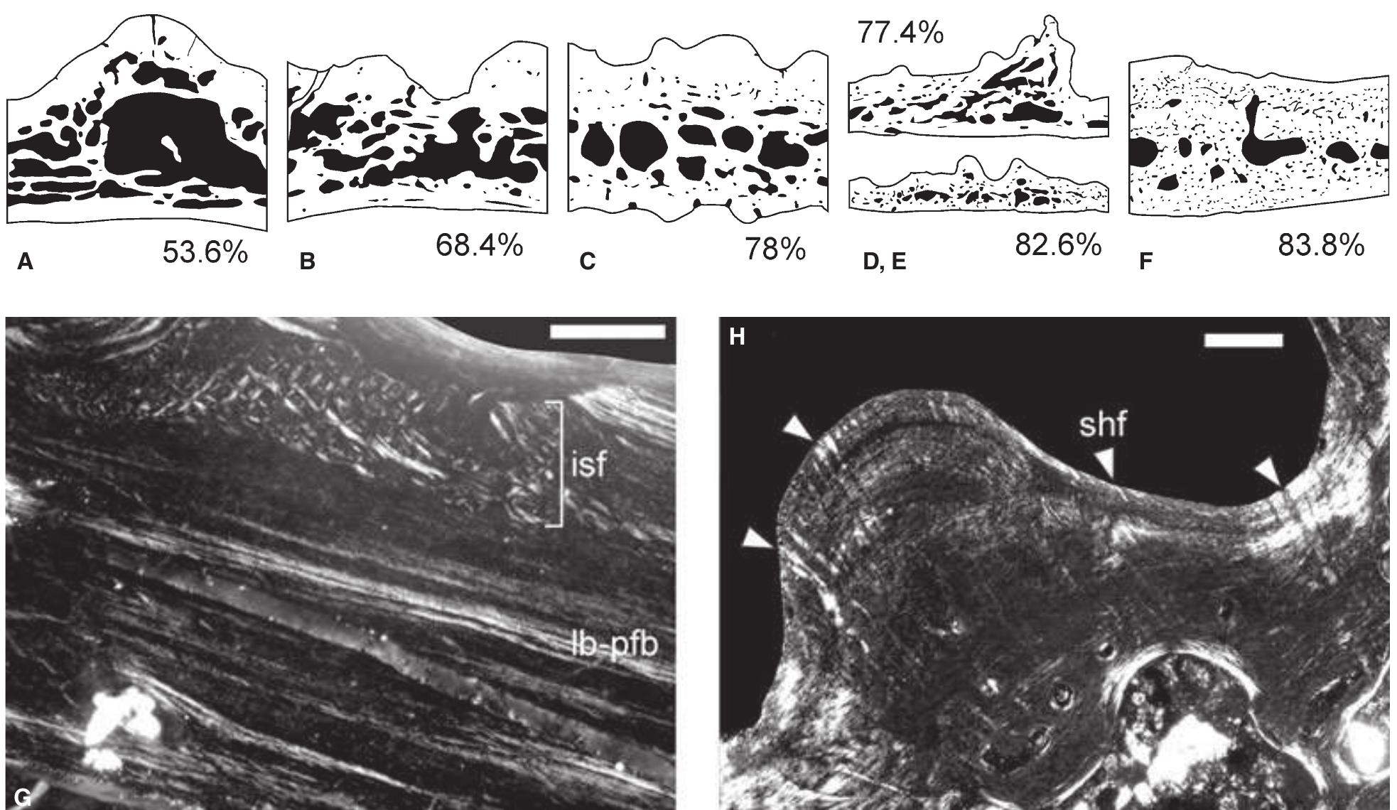 Osteohistological features included in the present