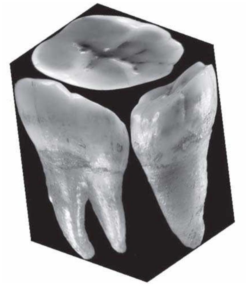 6- face model of a neanderthal tooth from hunas (germany)