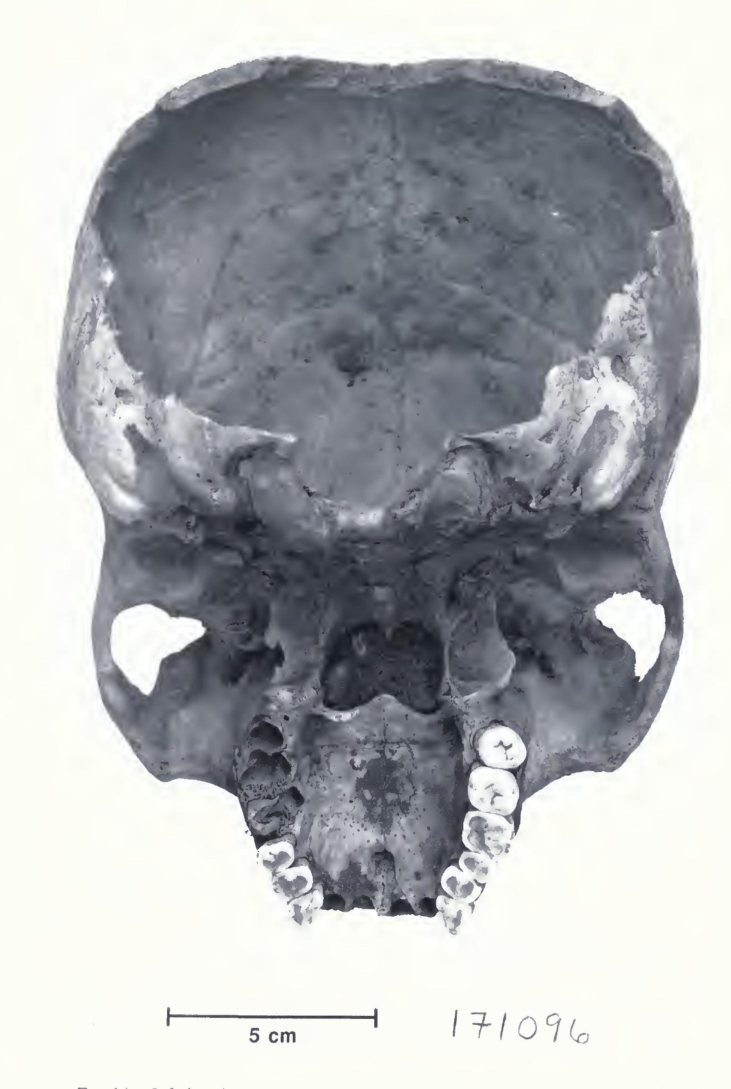 Figure 26 - An osteological study of Nasca trophy heads