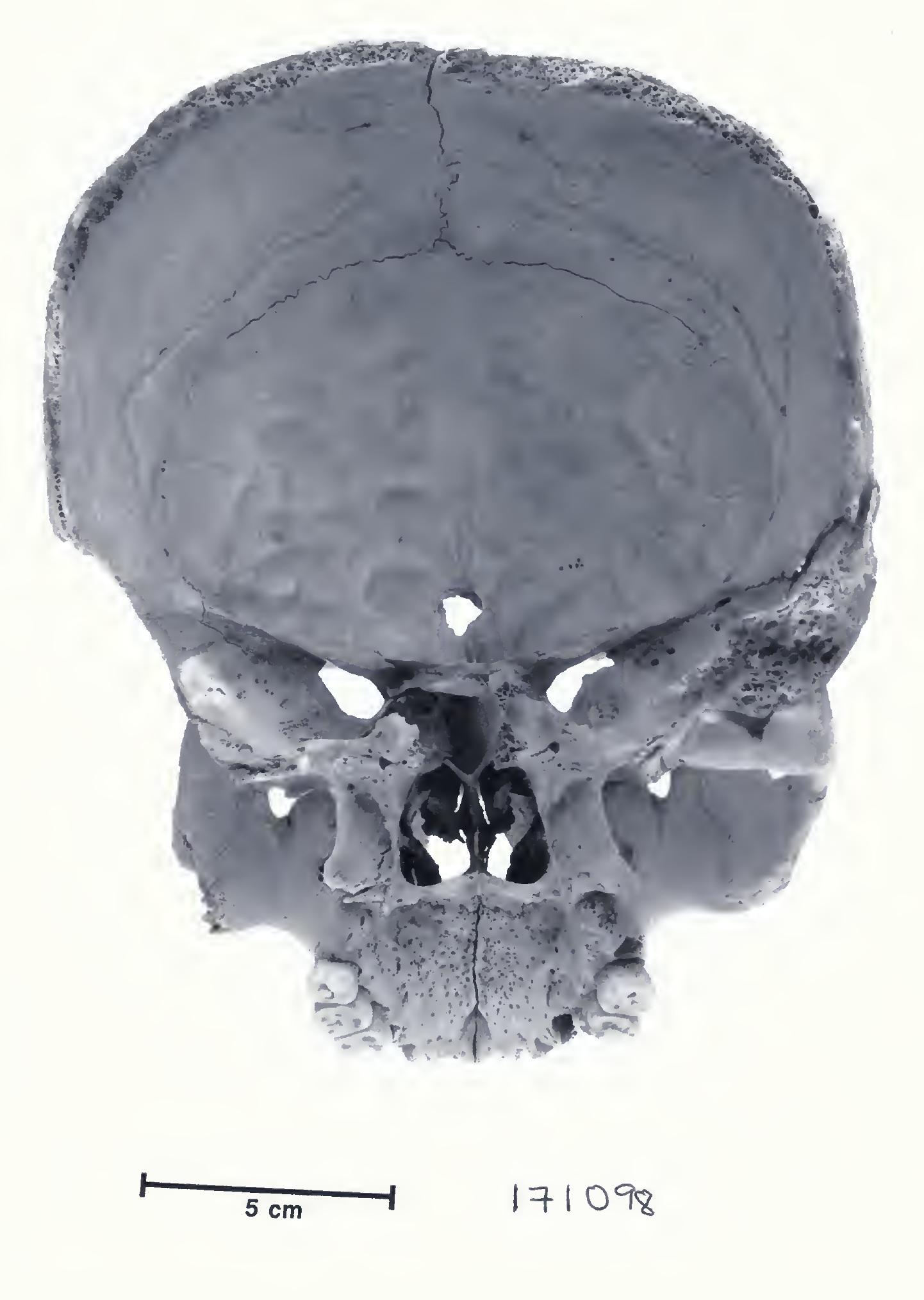 Figure 33 - An osteological study of Nasca trophy heads