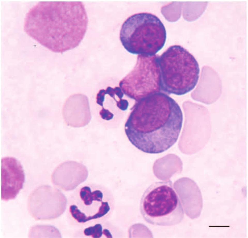 Blood smear from a dog with pure erythroid leukemia