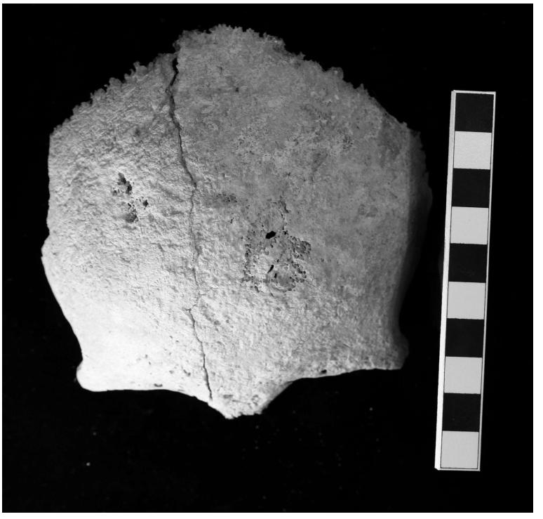4: cranial lesions on the frontal bone of 1146 the most