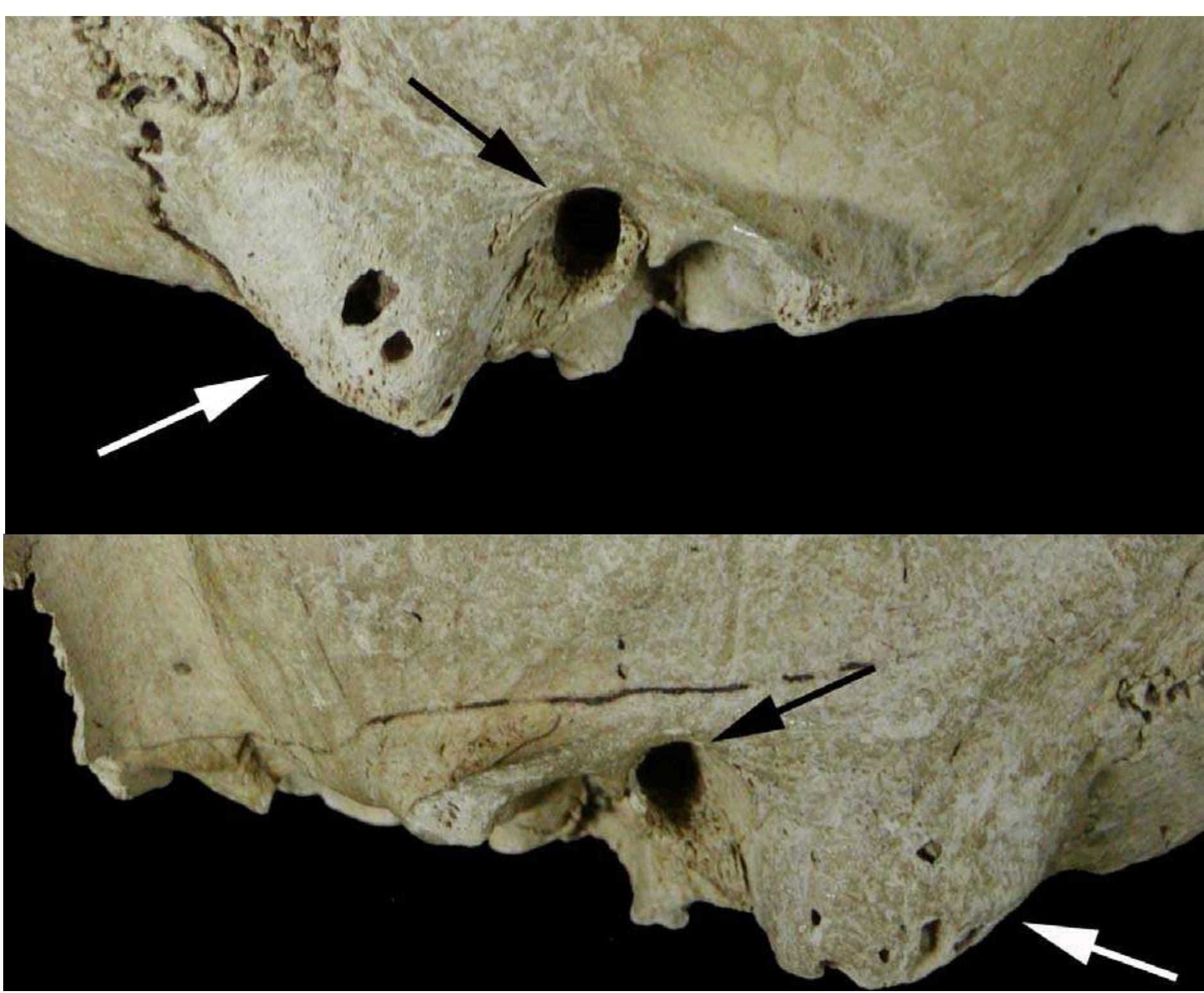 1. left and right mastoid processes.