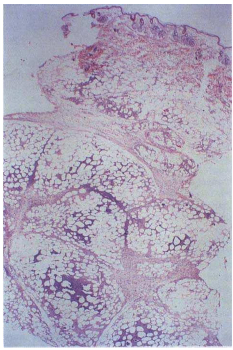 (PDF) Pansteatitis (Steatitis, Yellow Fat Disease) in the Cat