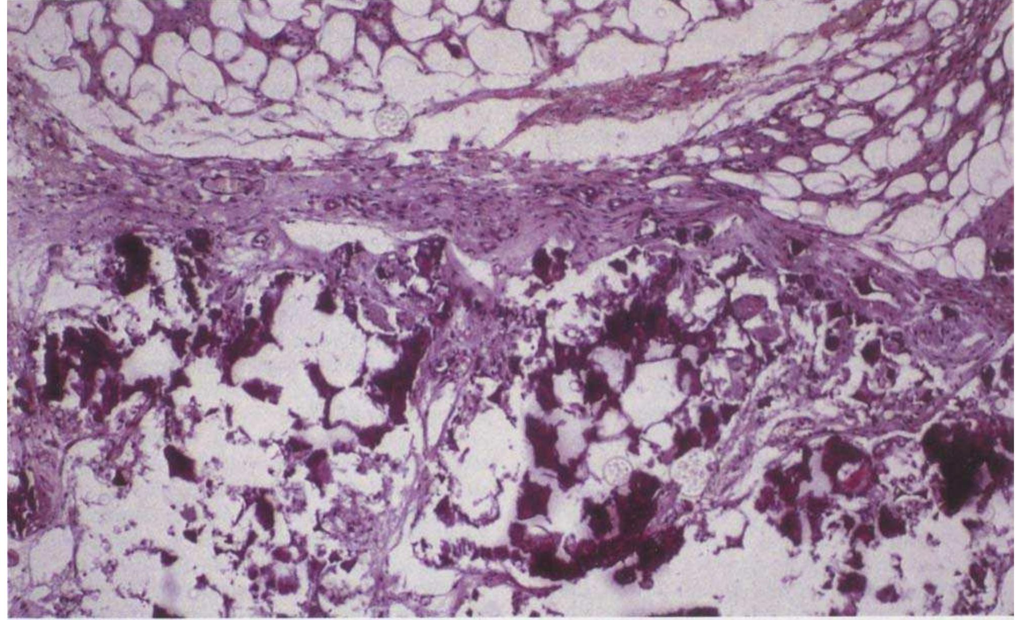 (PDF) Pansteatitis (Steatitis, Yellow Fat Disease) in the Cat
