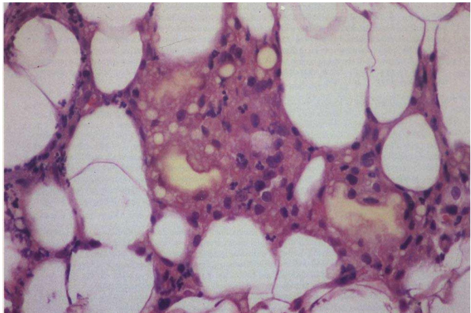 (PDF) Pansteatitis (Steatitis, Yellow Fat Disease) in the Cat