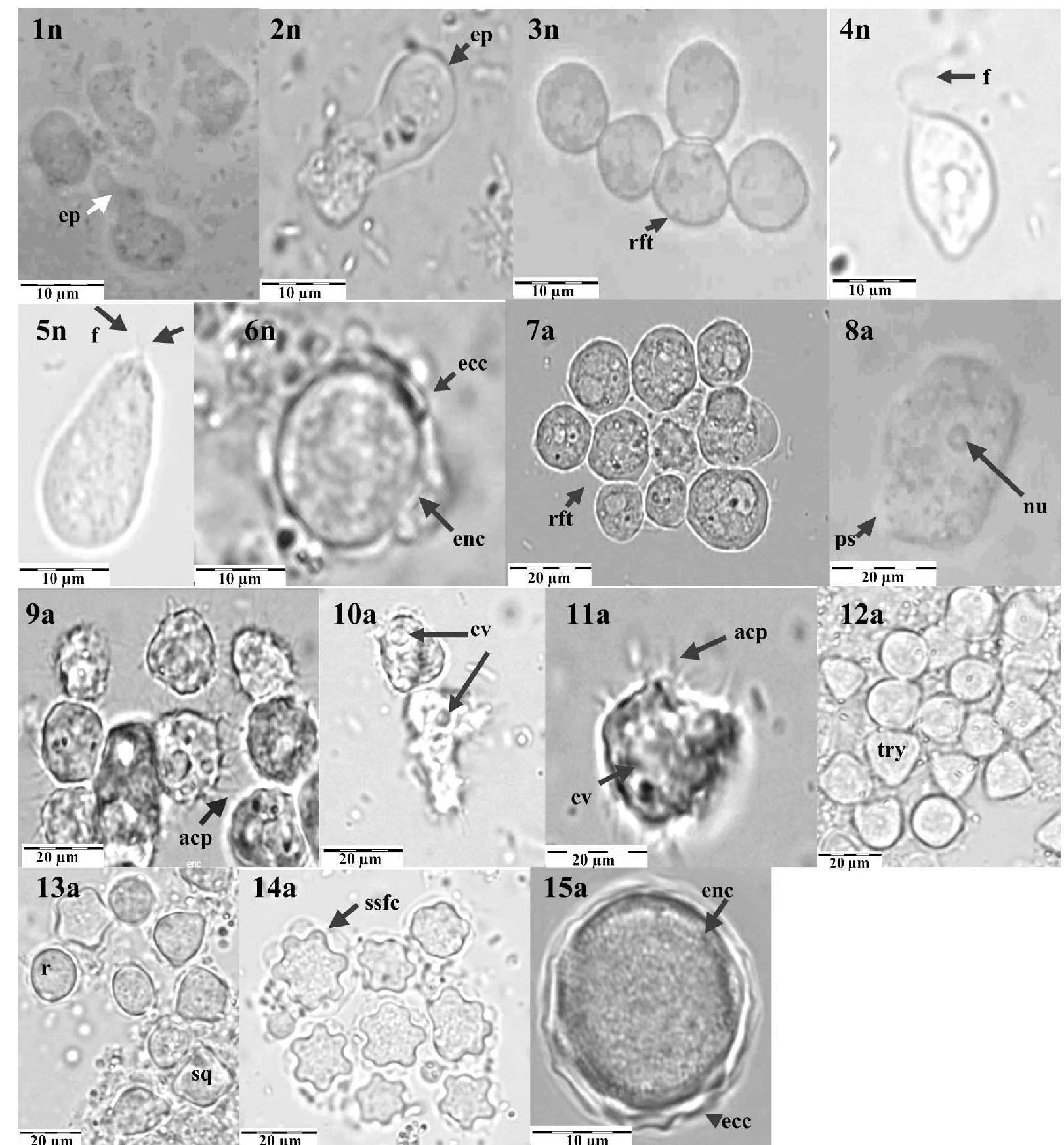 Unstained morphology of naegleria (n) and acanthamoeba (a)