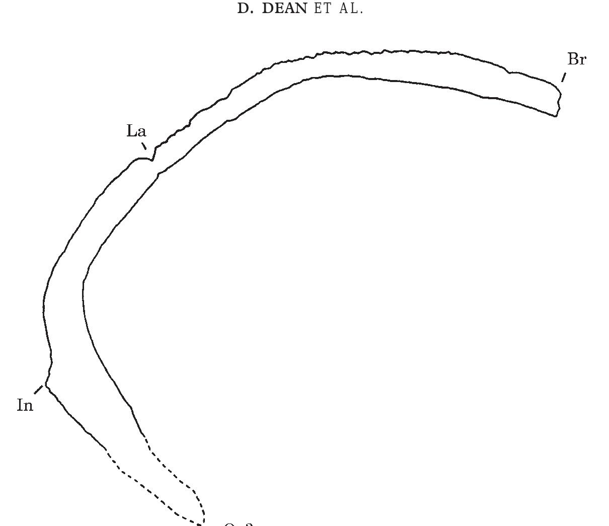 Mid-sagittal craniogram tracing of the reilingen skull.