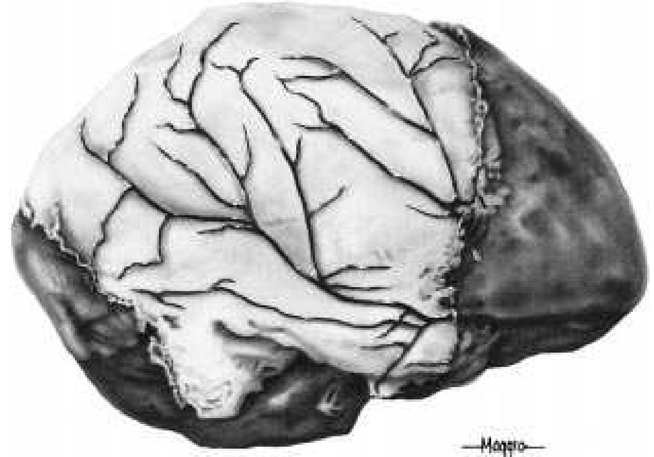 Reconstructed endocast. the reilingen endocast exhibits