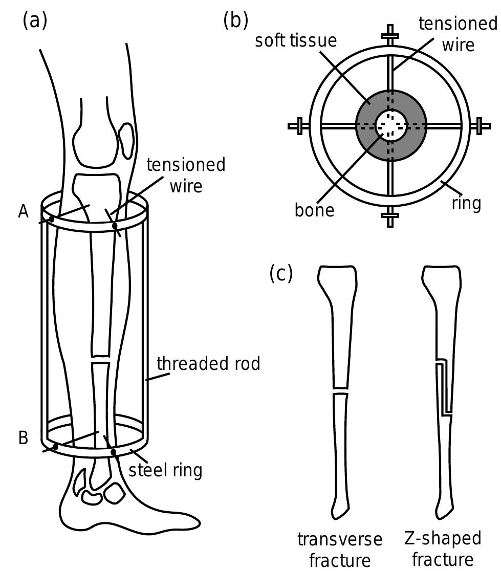 Figure 100 - from Human body dynamics