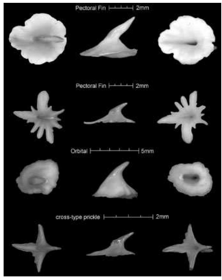Dermal denticles of raja montagui in dorsal view (left),
