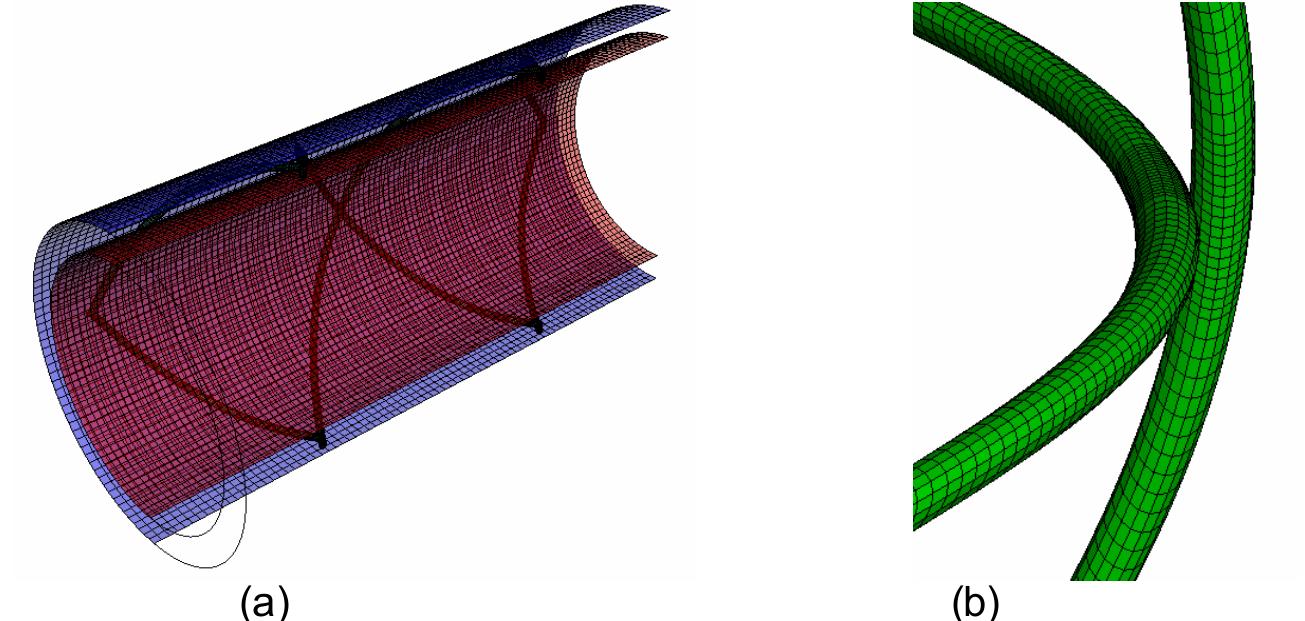 (a) sectional view of stenting system before analysis and