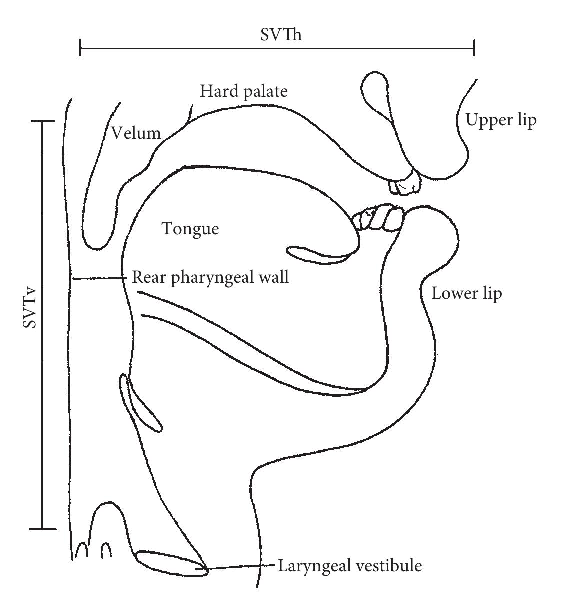 Adult human supralaryngeal vocal tract (svt) in a