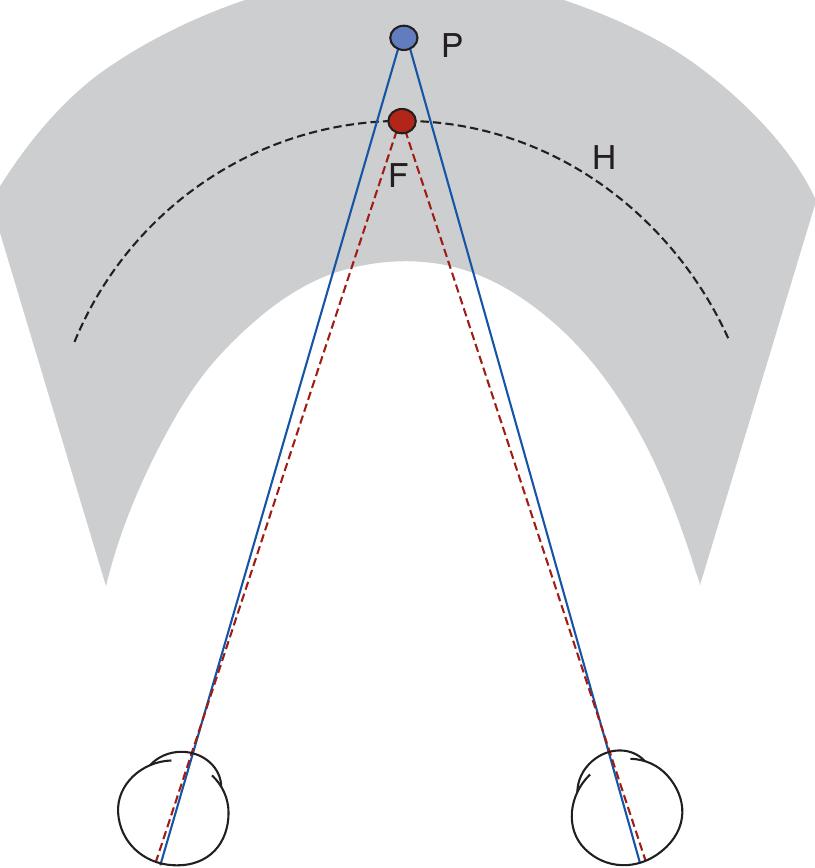 Panum’s fusional area is illustrated here in gray. within
