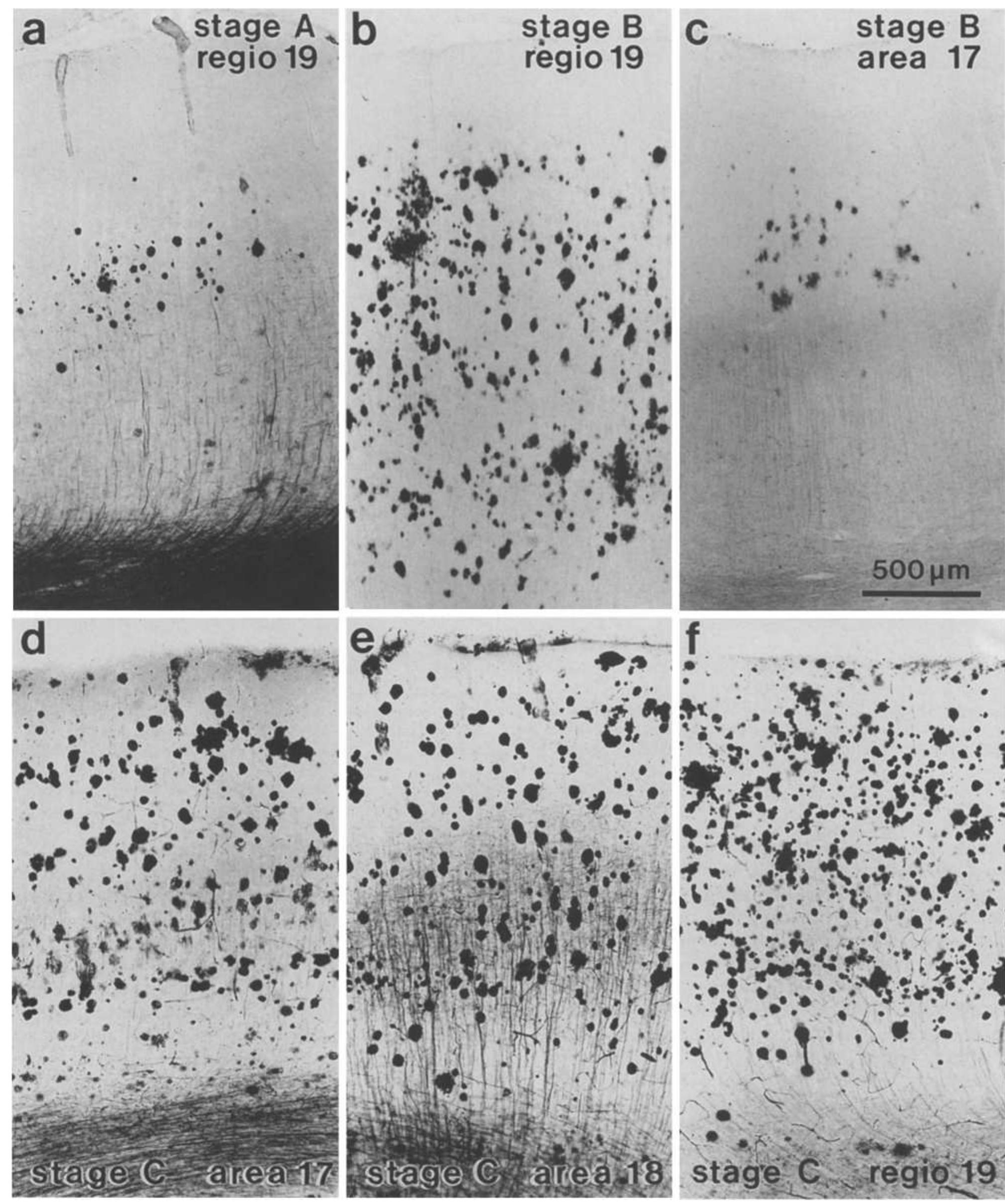 (PDF) Neuropathological stageing of Alzheimer-related changes