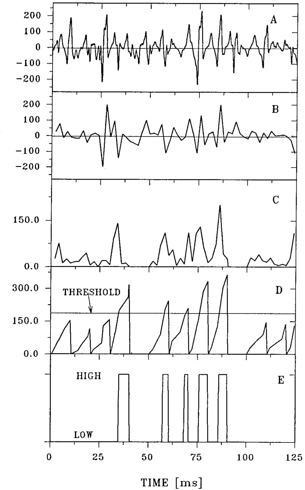 The signal shape at various stages of the analog processing