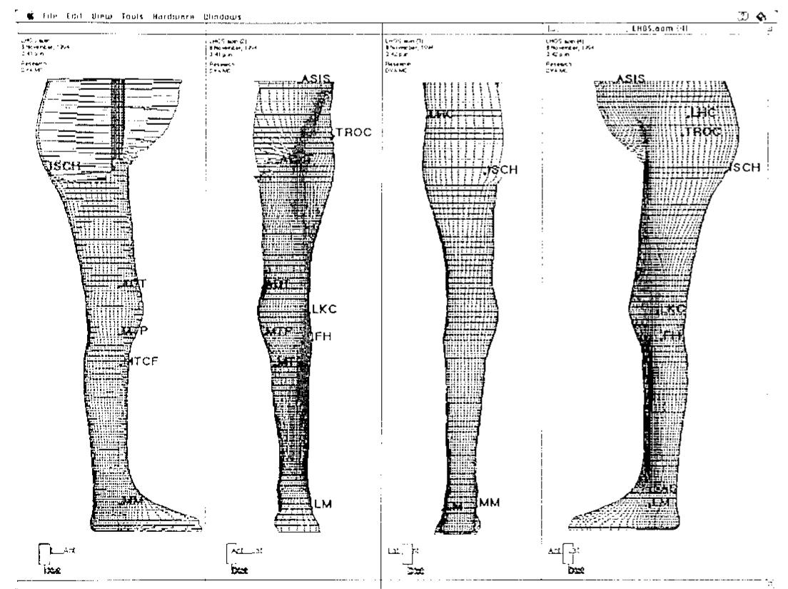 Lateral. posterior. anterior. and medial views of the