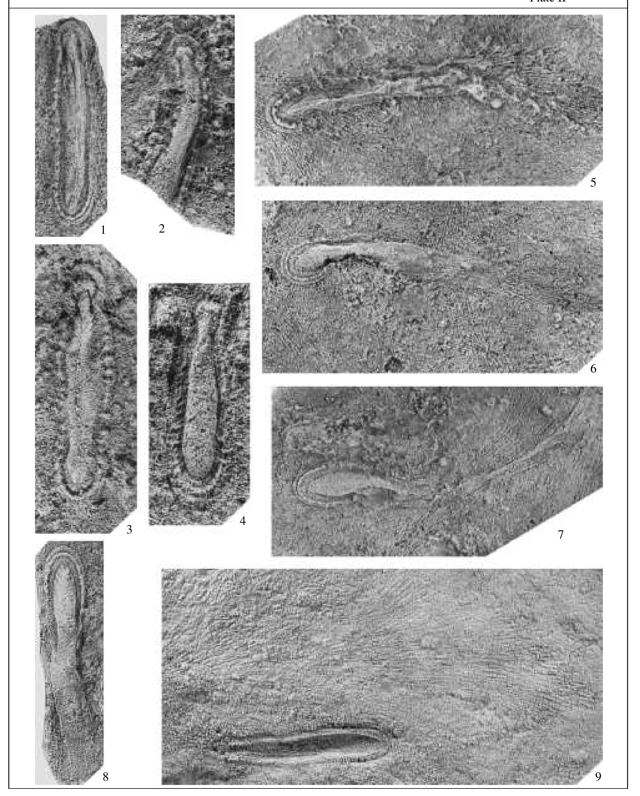 (PDF) A New Reconstruction of Kimberella , a Problematic Vendian Metazoan