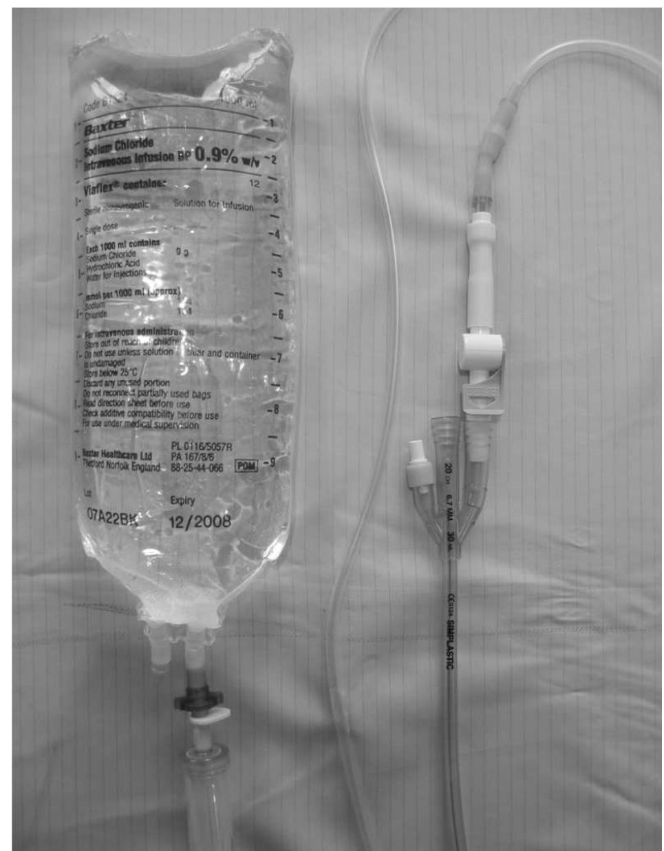 Improvised irrigant delivery system. the bard flip-flo®