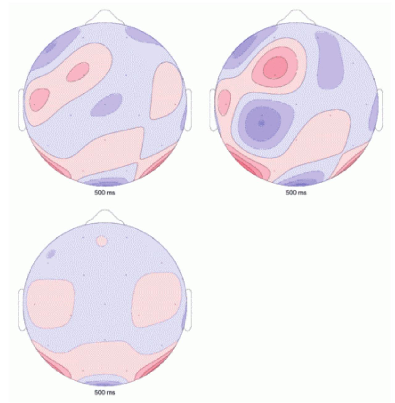S 2a-c. current source density (csd) maps of the scalp